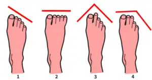 Toes: The Different Types